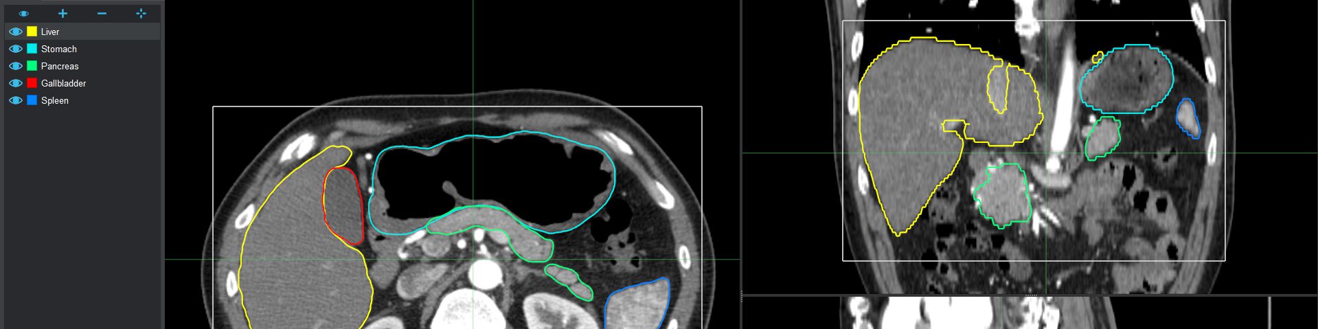 Oncosoft(인테그로) 기업, 채용, 투자, 뉴스